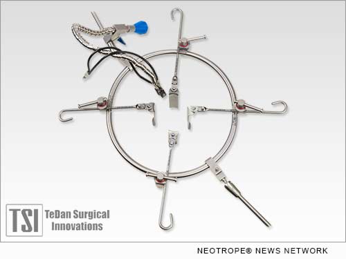 TeDan Surgical Innovations Launches MIS ALIF Retractor System, Provides ...
